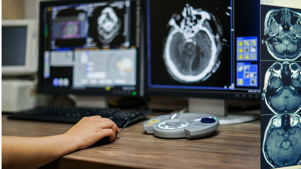 How Ai Is Revolutionizing Early Disease Detection Ntir India